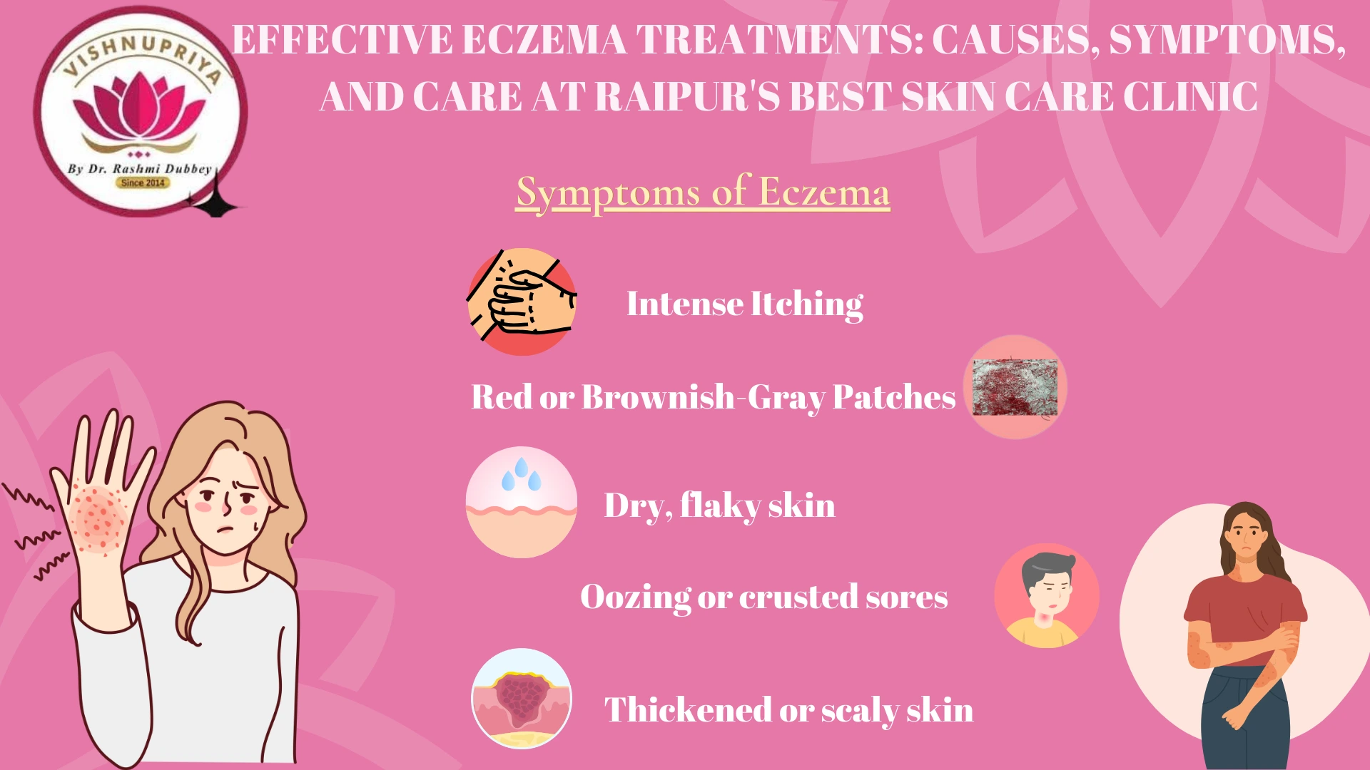 Effective Eczema Treatments: Causes, Symptoms, and Care at Raipur's Best Skin Care Clinic ...